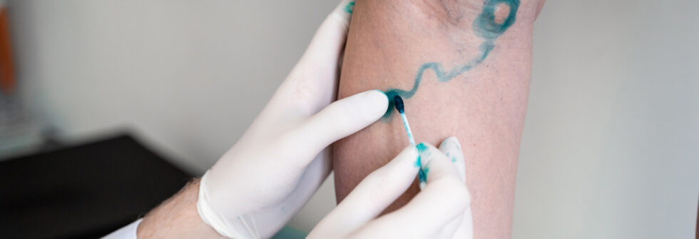 Vascular Surgery - Medinet UK